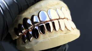Custom Grillz/Grills - The Spencer Road Dental Surgery | Dental Clinic ...